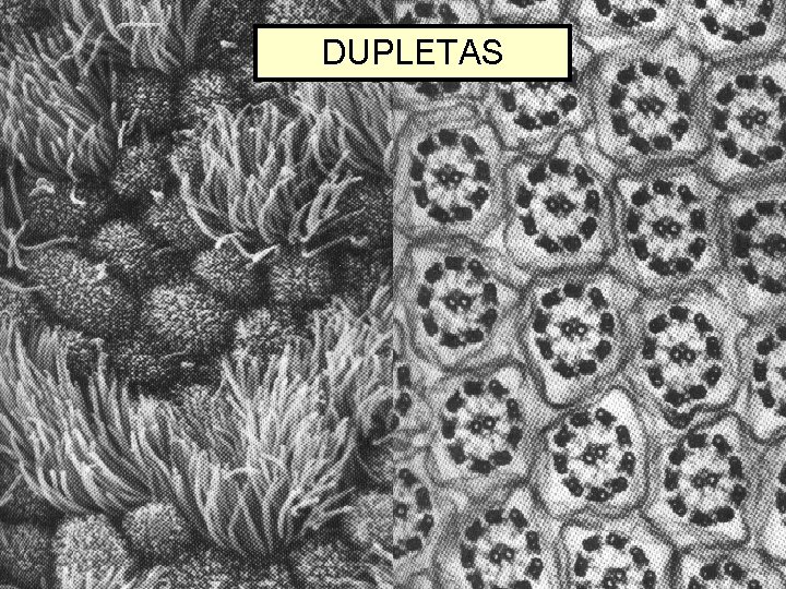 CITOESQUELETO Microtbulos Microfilamentos Filamentos Intermedios Red ...