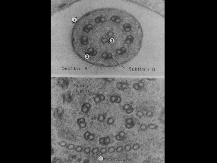 CITOESQUELETO Microtbulos Microfilamentos Filamentos Intermedios Red ...