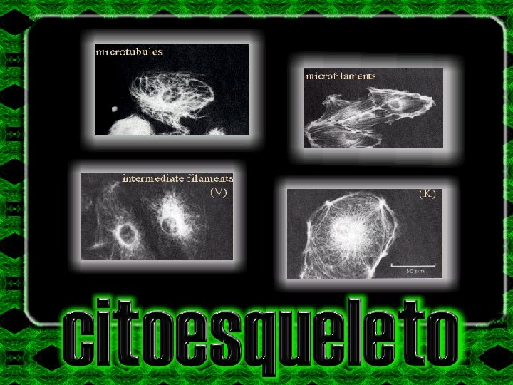 CITOESQUELETO Microtbulos Microfilamentos Filamentos Intermedios Red ...