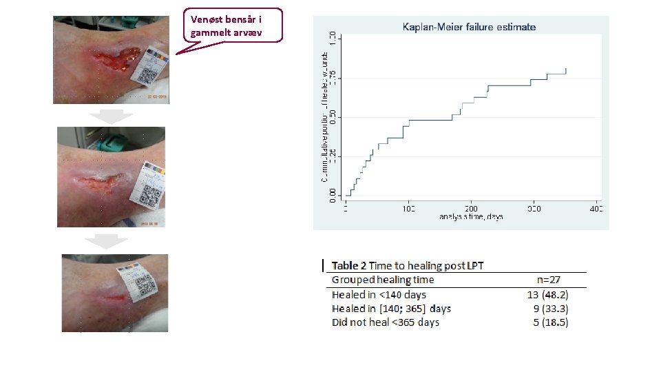 Leuco Patch det levende plaster kun til diabetiske