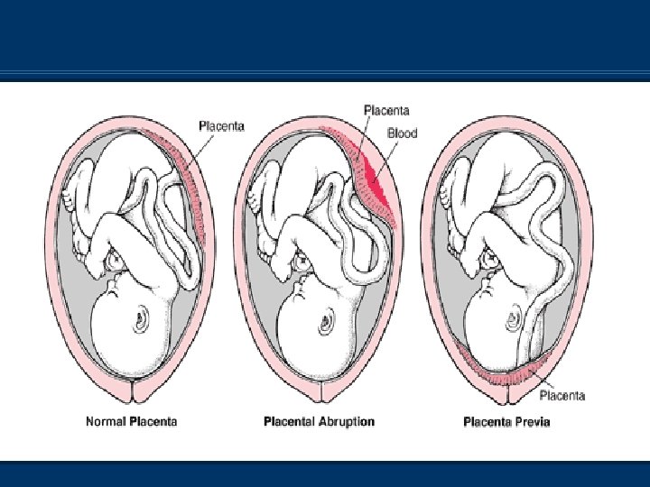 Prenatal and Perinatal History LOG 2 Learning objectives
