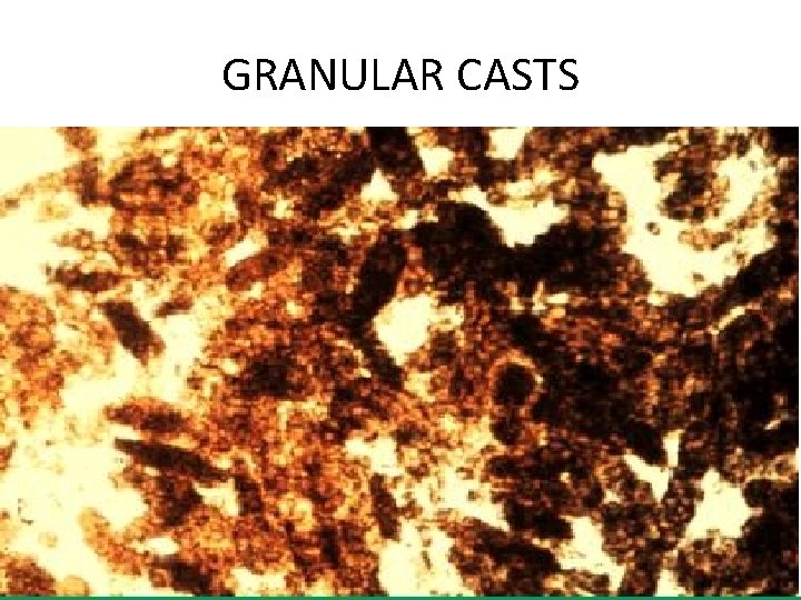 ACUTE KIDNEY INJURY IN ICU MODERATOR Dr Apurba