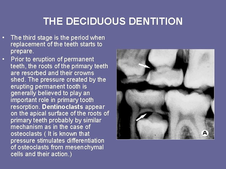 DEVELOPMENT OF THE DENTITION THE DECIDUOUS DENTITION The