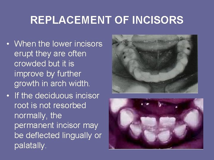 DEVELOPMENT OF THE DENTITION THE DECIDUOUS DENTITION The