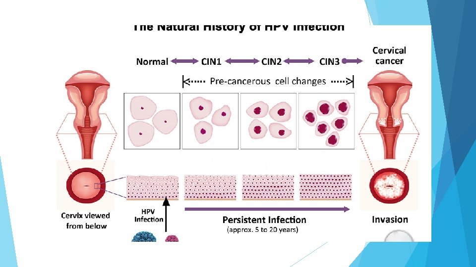 CERVICAL LESIONS DR LAMA ALMEHAISEN MD MRCOG CONSULTANT