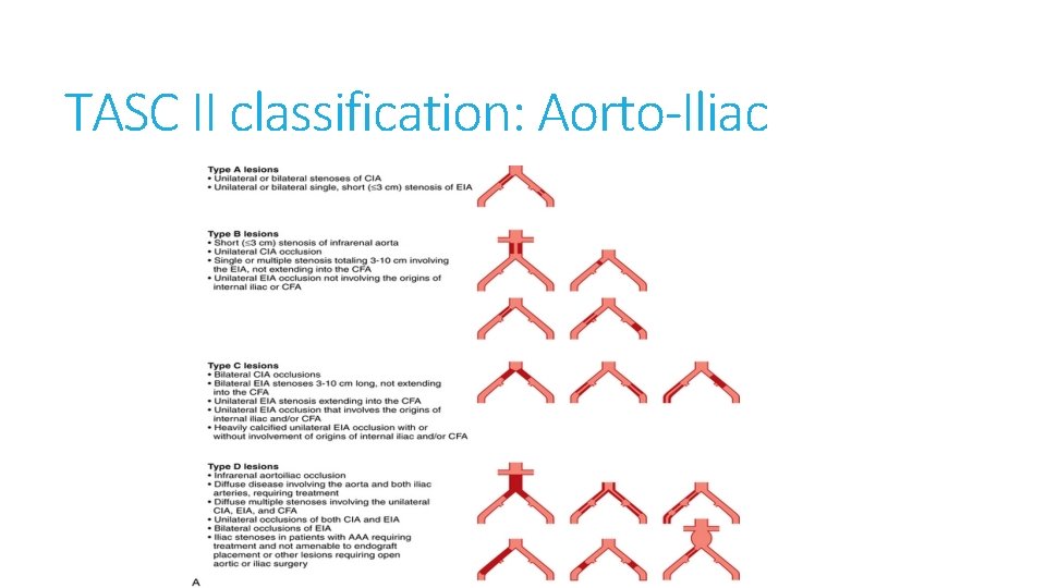 Peripheral Arterial Disease Surgery Risks and Benefits Gregory