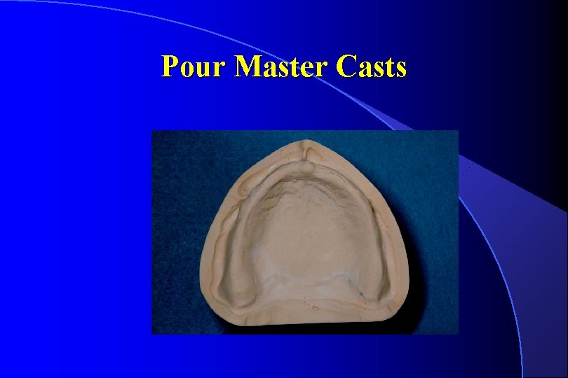 Laboratory stages of manufacture of complete dentures Peculiarities