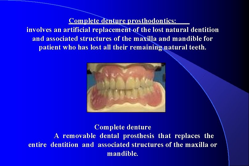 Laboratory stages of manufacture of complete dentures Peculiarities