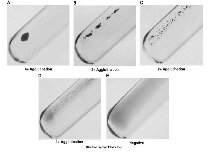 MLS 412 ANTENATAL SEROLOGYANTIBODY IDENTIFICATION AKINBO D B