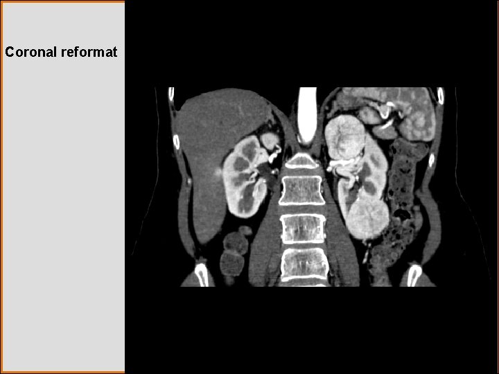 Radiological Category Body Principal Modality CT Case Report