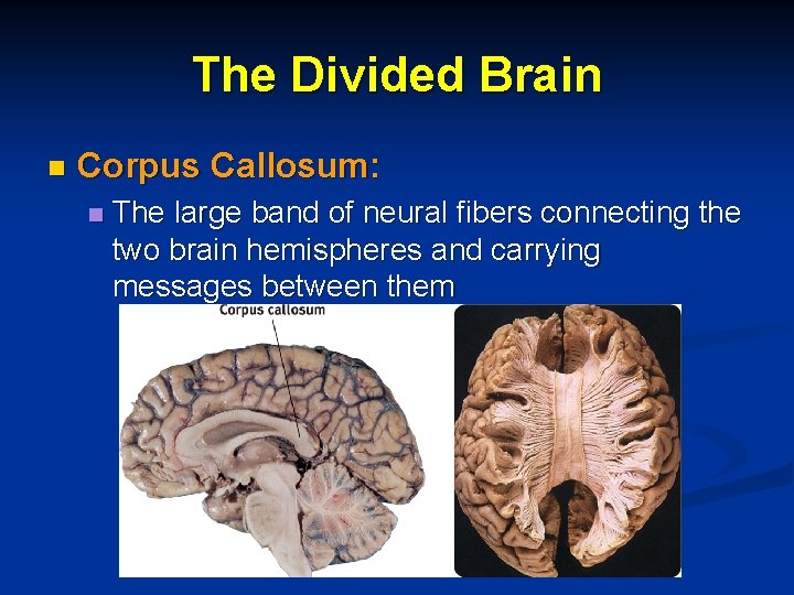 Chapter 2 I RightLeft Differences in the Brain