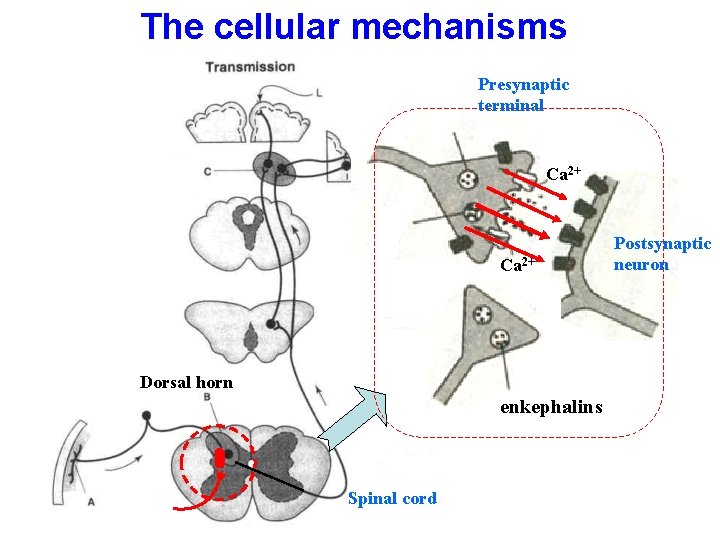 Analgesics Zhang Bin a Acute pain sharp pain