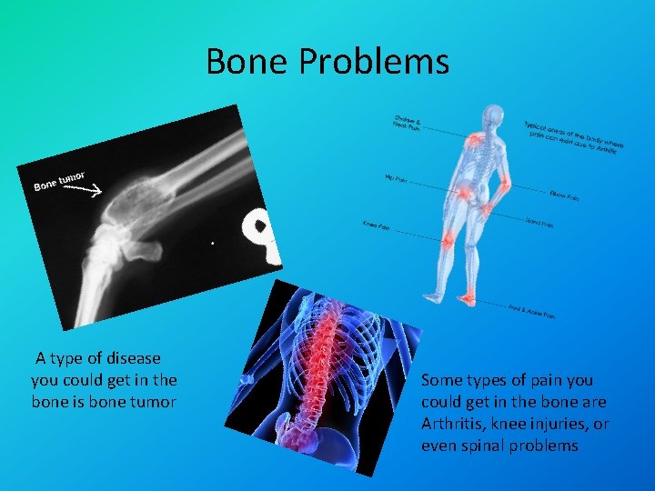 Musculoskeletal System BY MARIAM AND VIVIAN Bones Different