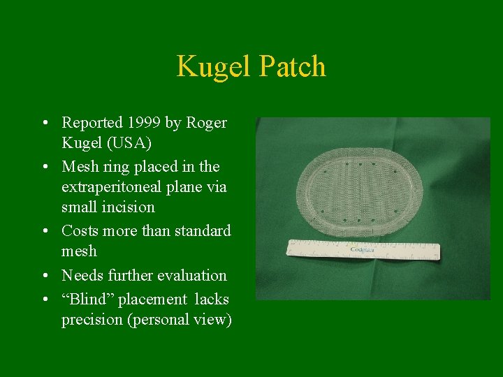 HOW SHOULD INGUINAL HERNIAS BE REPAIRED IN 2001