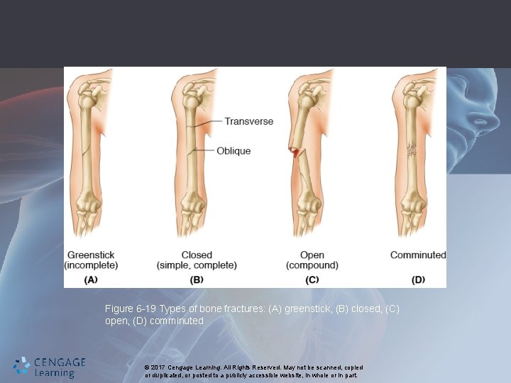 Chapter 6 Skeletal System 2017 Cengage 2017 Learning