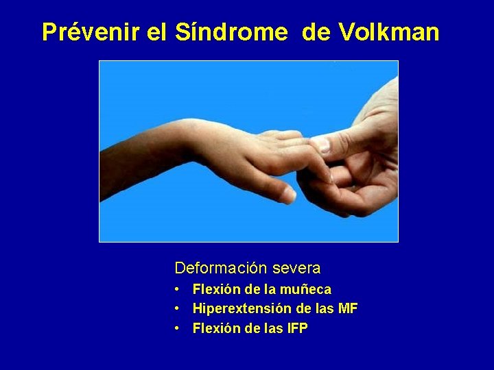 Generalidades sobre las Fracturas de los Miembros Desde