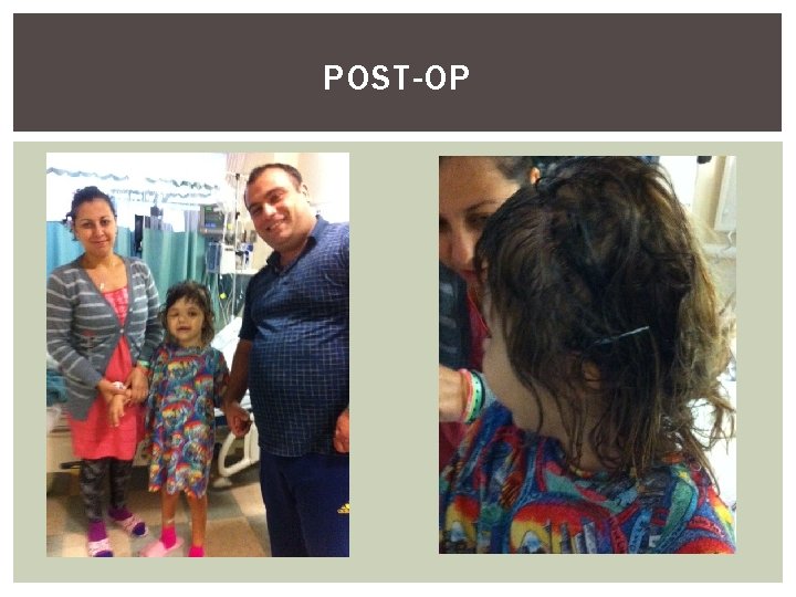 CRANIOSYNOSTOSIS A CASE OF APERT SYNDROME Victoria Schunemann