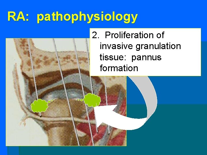 Rheumatology Normal Anatomy and Physiology Synovial joints Normal