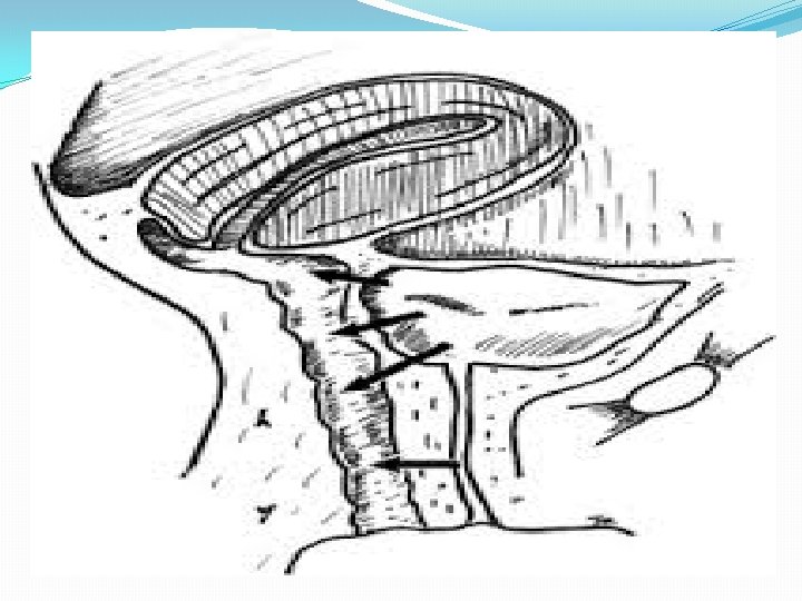 Genitourinary Fistula F I C O G Objectives