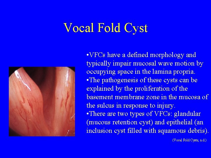 Nodules and Polyps By Lindsey Richter Presented to