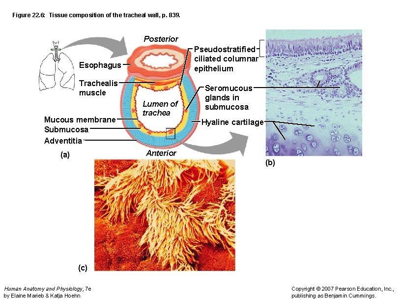 Chapter 22 The Respiratory System Alexander Graham Bell