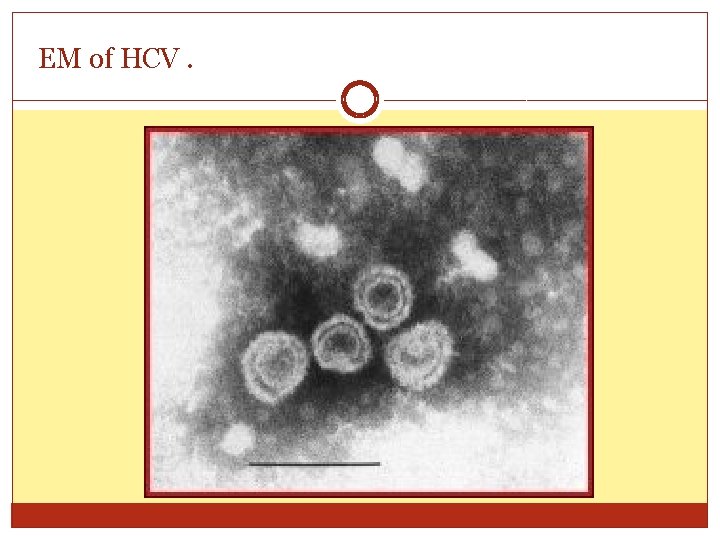 Bloodborne hepatitis parenterally transmitted hepatitis DR MOHAMMED ARIF