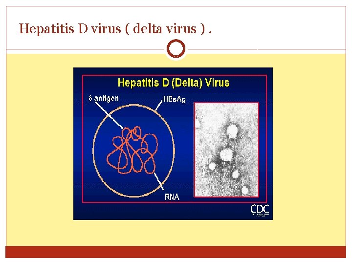 Bloodborne hepatitis parenterally transmitted hepatitis DR MOHAMMED ARIF