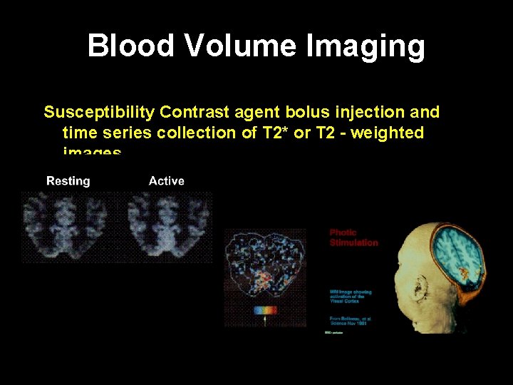 Functional MRI Mechanisms and Limits Peter A Bandettini