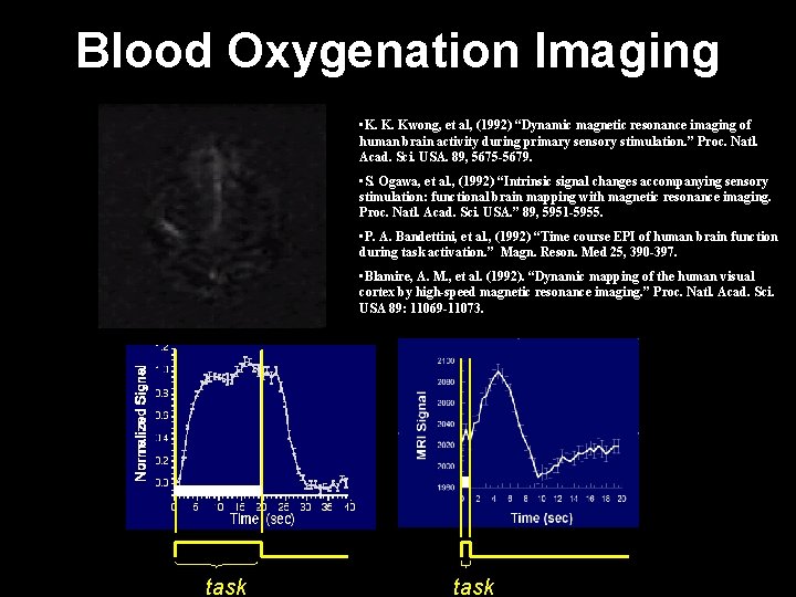 Functional MRI Mechanisms and Limits Peter A Bandettini