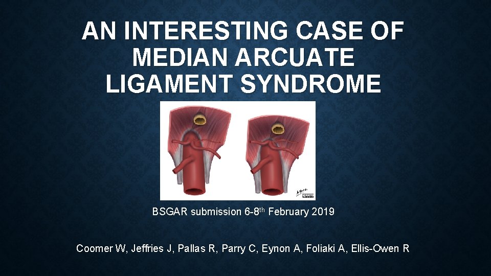 AN INTERESTING CASE OF MEDIAN ARCUATE LIGAMENT SYNDROME