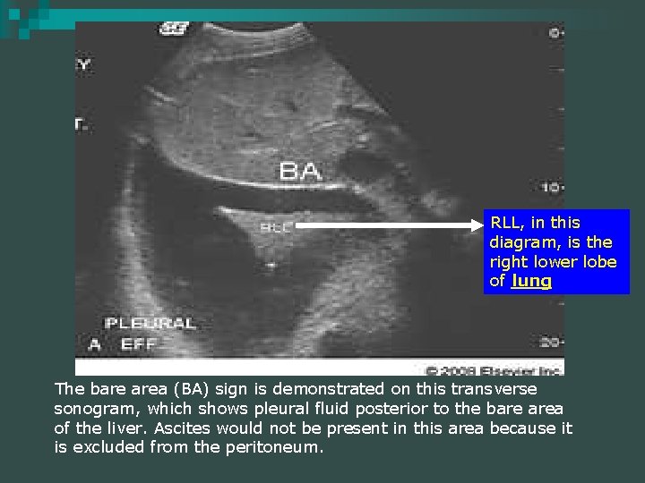 Lackawanna College Diagnostic Medical Sonography Program Abdominal ...