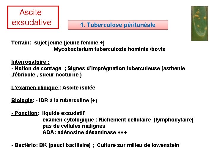 Conduite A Tenir devant ascite Dr A REHAMNIA