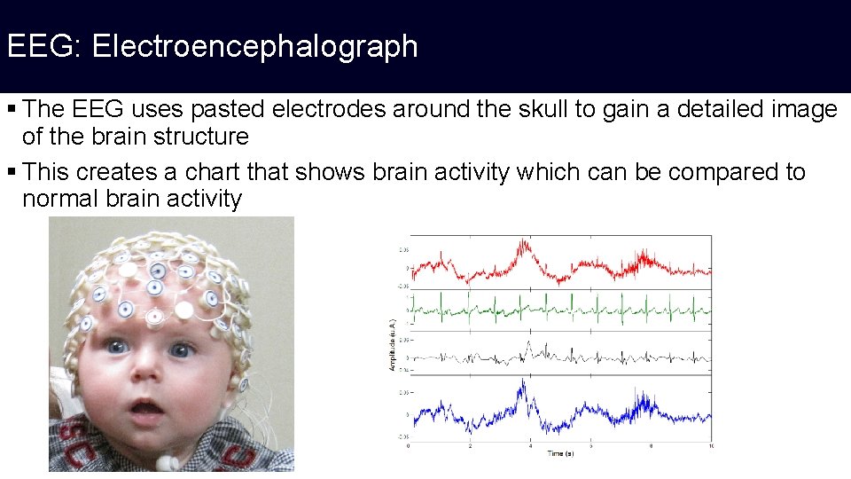 Unit 3 Biopsychology Part 1 The Brain The