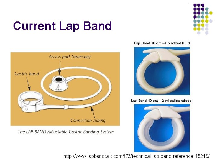 SelfAdjusting Gastric Banding System Erin Crosby Andrew Dickerman