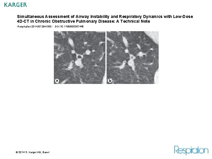 Simultaneous Assessment of Airway Instability and Respiratory Dynamics