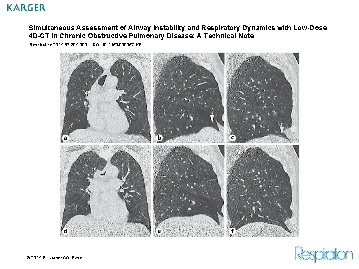 Simultaneous Assessment of Airway Instability and Respiratory Dynamics