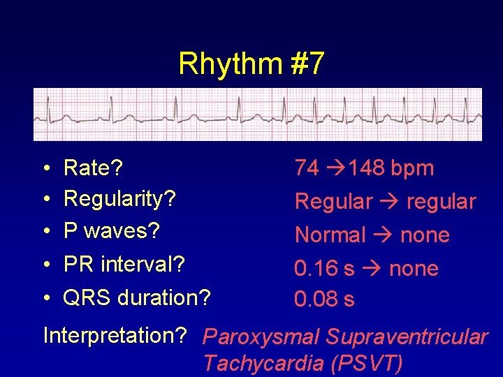 ECG Rhythm Interpretation Module IV b Supraventricular and