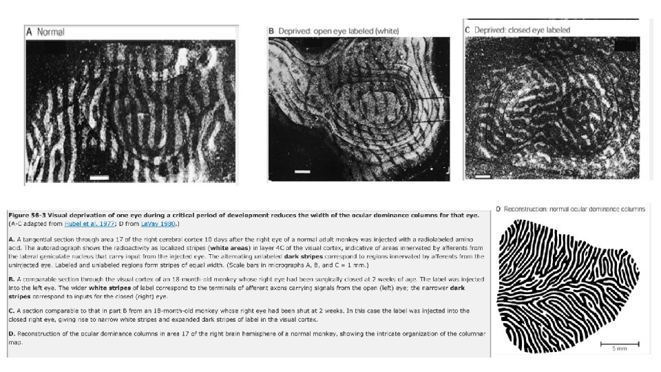 History of Neurology DAVID H HUBEL MD TORSTEN