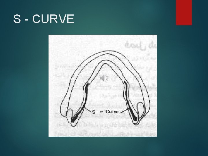 Mandibular Basal Coverage Dr Neshati Mandibular Bone Condyls