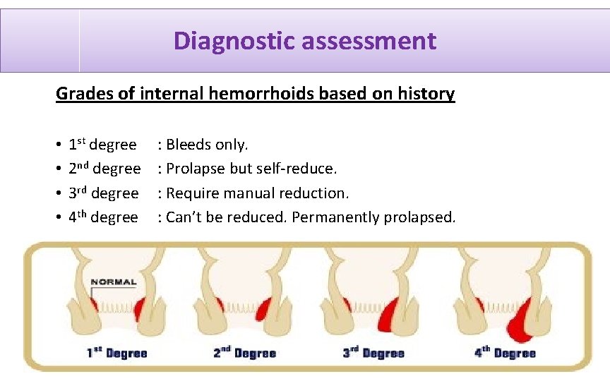 Management of Benign Anorectal disorders ACG Clinical Guideline