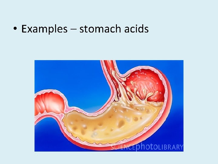 Diseases Disease Any malfunction of the body genetic