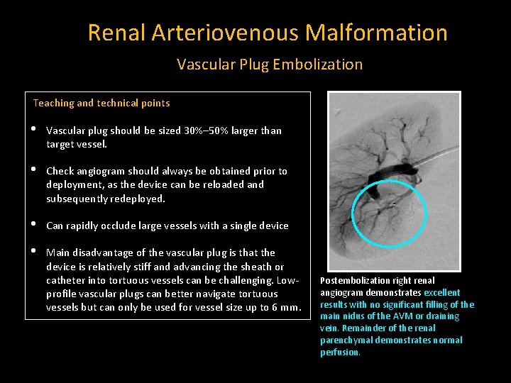 Casebased Review of Endovascular Renal Interventions Primer for