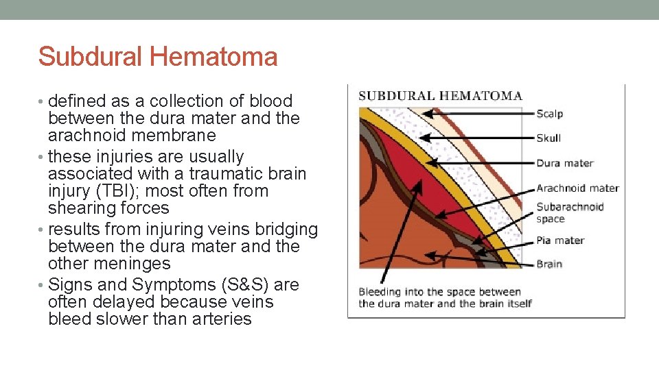 CURRENT TRENDS IN MANAGING SUBDURAL HEMATOMA INJURIES When