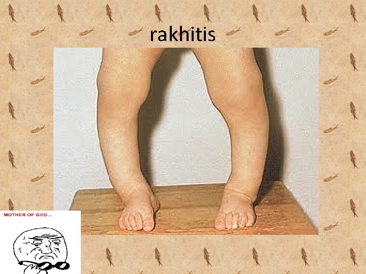 Sistem sistem gerak gangguan dan kelainan Kelompok Fazry