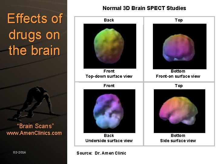 Effects of drugs on the brain Normal 3