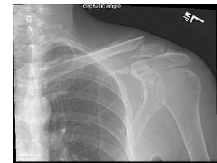 The Appendicular skeleton Appendage add on limb Why