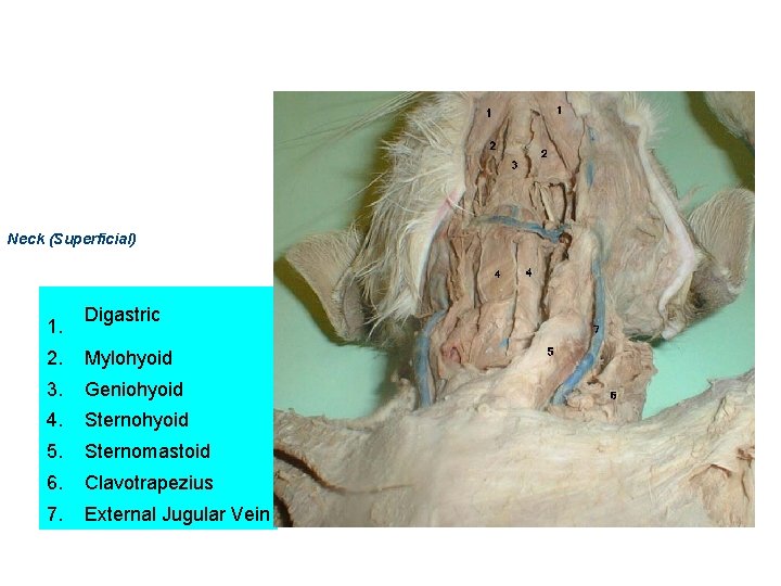 Neck Superficial 1 Digastric 2 Mylohyoid 3 Geniohyoid