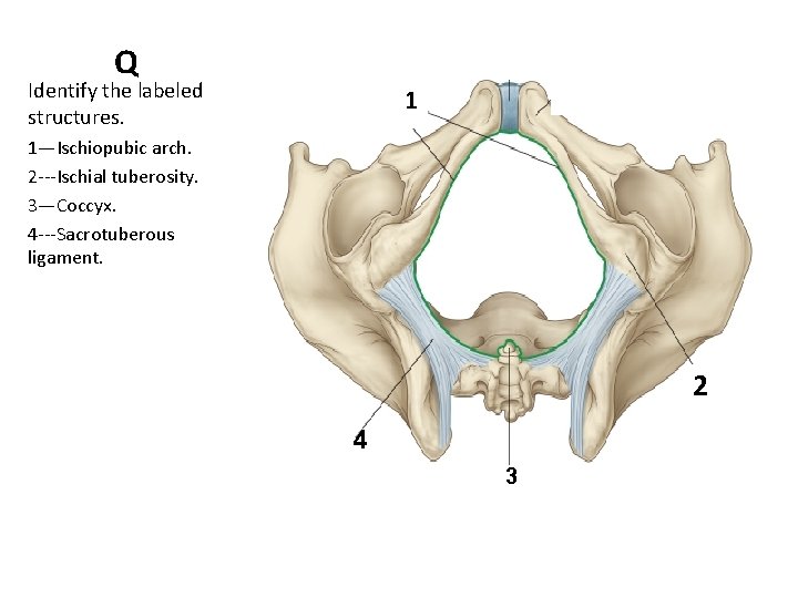 OSPE Reproductive Block ANATOMY Q Identify the labeled