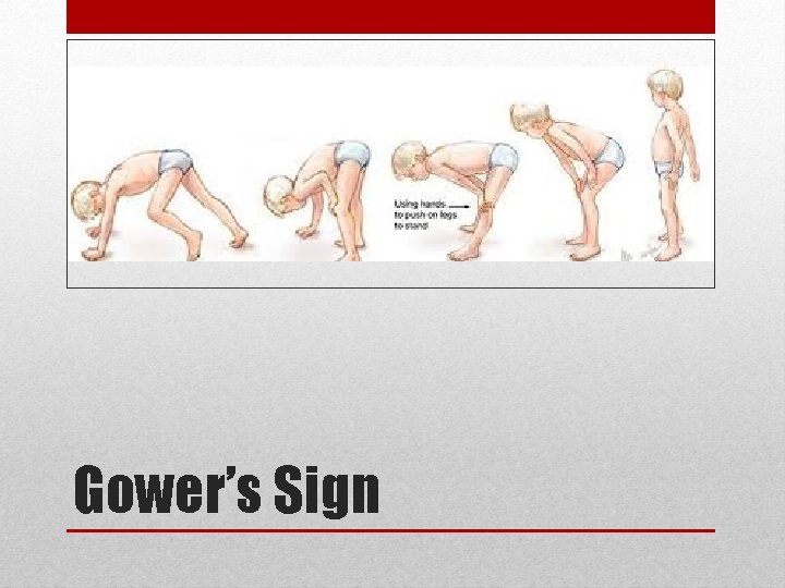 Hypotonia Dana Hasbini MD MSc Pediatric Neurology Rafic