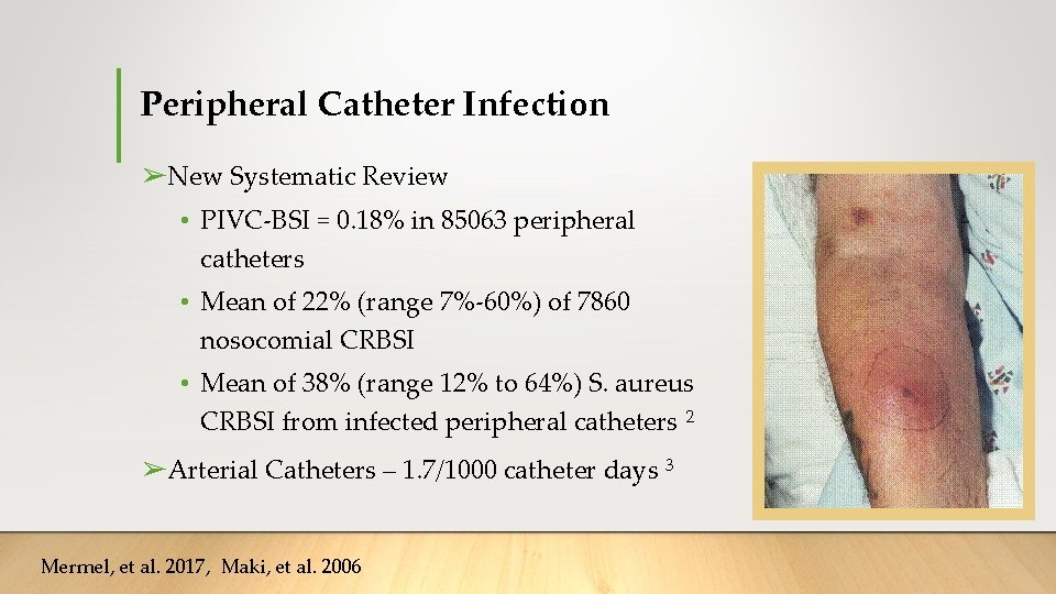 Tissue Adhesive A New Tool for the Vascular